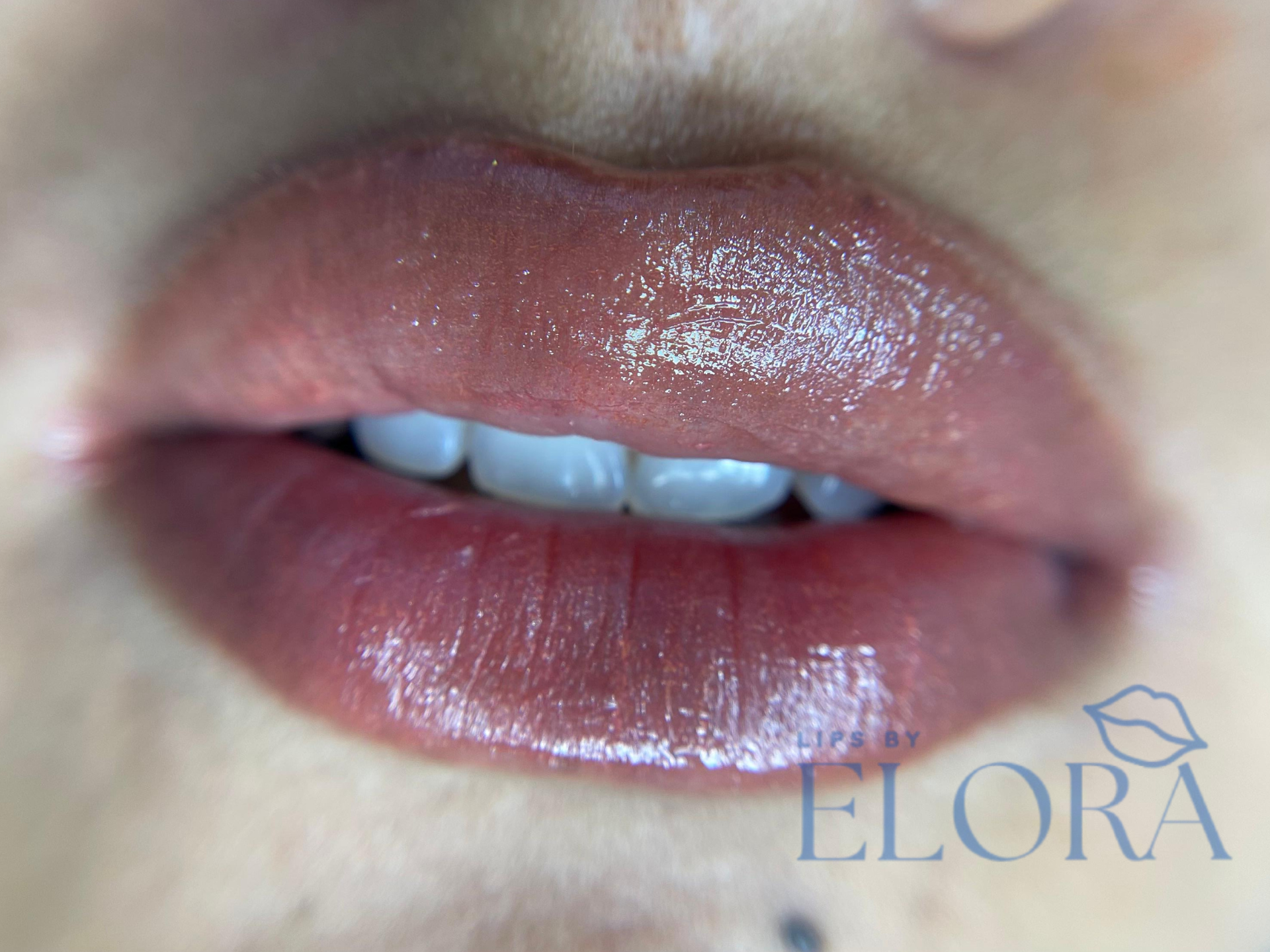 Permanent Lip Makeup | Lip Blush & Dark Lip Correction | Elora's